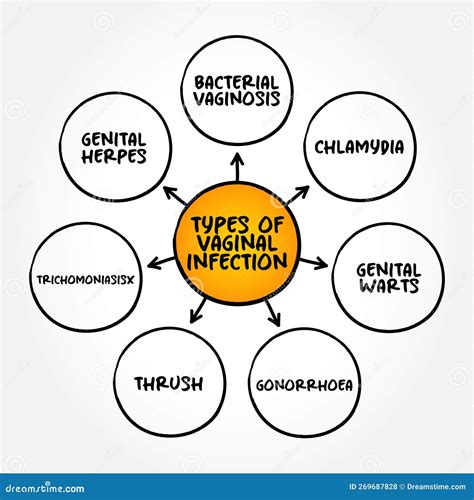Types Of Vaginal Infection Mind Map Text Concept For Presentations And