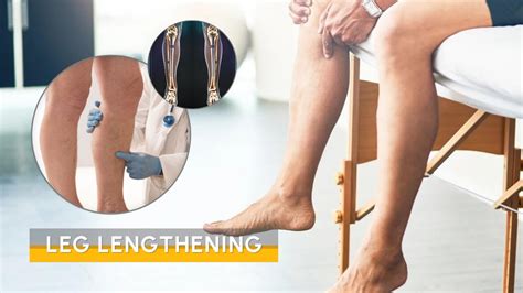Limb Lengthening Surgery In Turkey To Increase Your Height Turquie