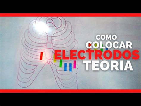 Guía para Colocar los Electrodos Aprende Dónde y Cómo