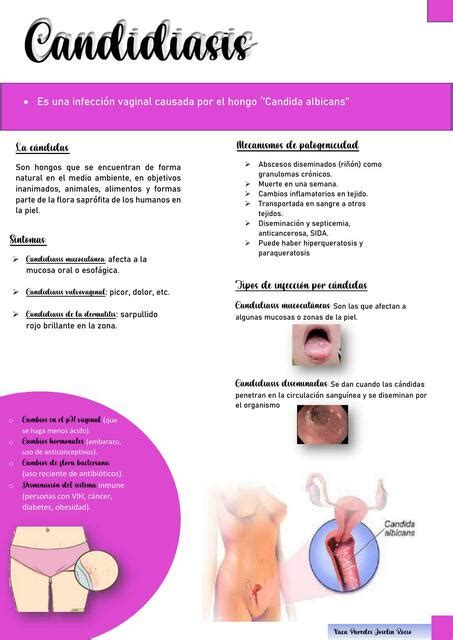 Infograf A Candidiasis Joselin Vaca Paredes Udocz