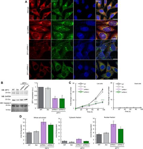 Frontiers ZIP11 Regulates Nuclear Zinc Homeostasis In HeLa Cells And