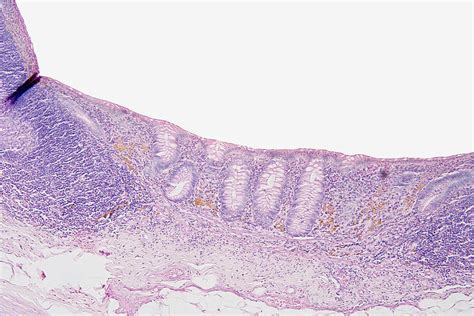 Cross Section Of Human Appendix Lm Photograph By Science Stock