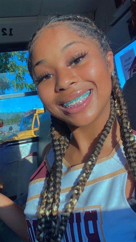 Pin By Unique Henderson On Pins By You Braces Colors Cute Braces