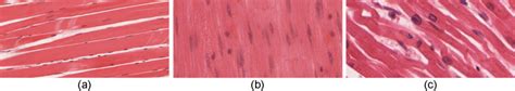 Types Of Muscle Tissues Anatomy And Physiology I Study Guides