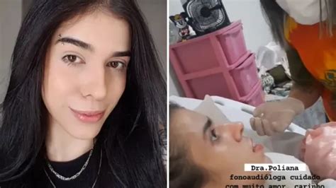 Acidente jovem que teve reação alérgica após cheirar pimenta