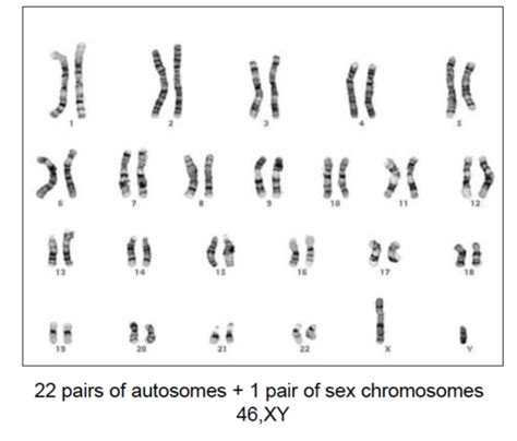 Quiz Lec Chromosomal Abnormalities Flashcards Quizlet