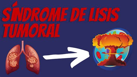 Actualización Síndrome de Lisis tumoral YouTube