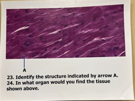 Histo Practice Midterm Flashcards Quizlet