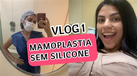 VLOG 1 MAMOPLASTIA REDUTORA SEM SILICONE YouTube