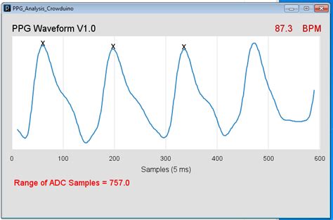 pc based heart rate monitor using arduino and easy pulse sensor embedded lab