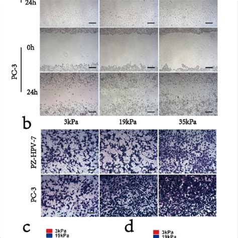 Effect Of Substrate Stiffness On The Migration Of HPV PZ 7 And PC 3