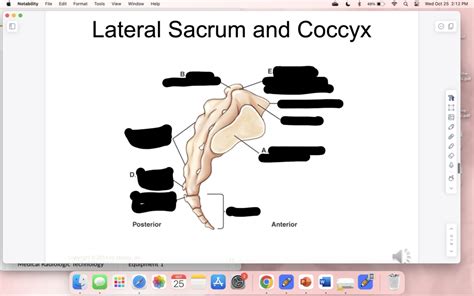 Test 3 Lateral Sacrum And Coccyx Diagram Quizlet