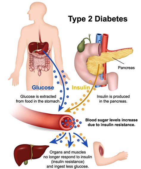 How Do Insulin And Glucagon Regulate Blood Sugar Levels Tandem