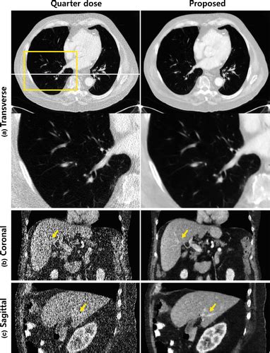 a deep convolutional neural network using directional wavelets for low‐dose x‐ray ct
