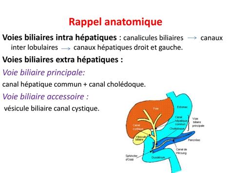 La Lithiase De La Voie Biliaire Principale LVBP Et Complications