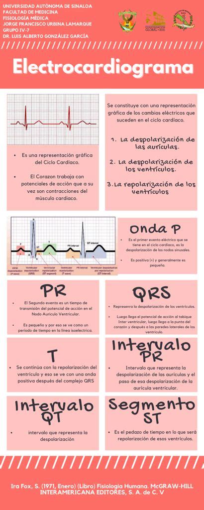 ELECTROCARDIOGRAMA