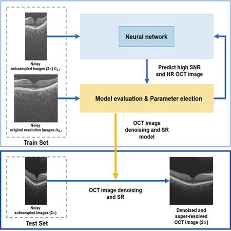 n2nsr‐oct simultaneous denoising and super‐resolution in optical coherence tomography images