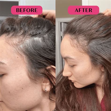 Buy Kerotin Intensive Growth Drops Rosemary Oil Peptides Minoxidil