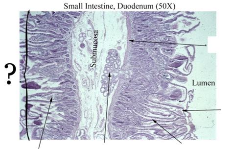 Small Intestine Duodenum Histology Flashcards Quizlet Hot Sex Picture