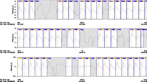 Figure From An Algorithm For Real Time Pulse Waveform Segmentation