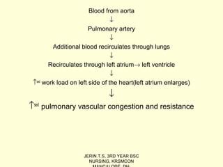 Patent Ductus Arteriosus PPT