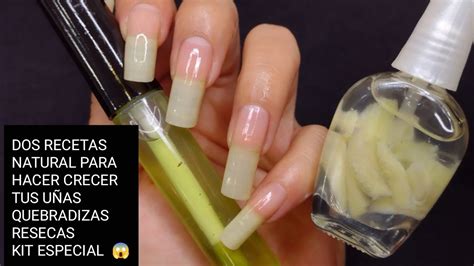 Aprender acerca 99 imagen como hacer que crezcan las uñas rapido y