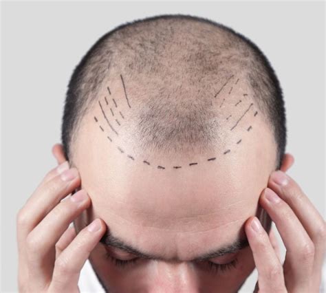 Radiant Dermatology