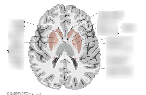 Coronal Brain Diagram Quizlet