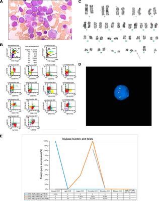 Frontiers BCR ABL1 Positive Acute Lymphoblastic Leukemia Following