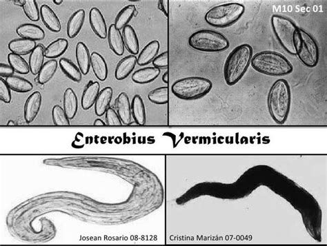 Enterobius Vermicularis Mikrobiyoloji Microbiology Microbiologia