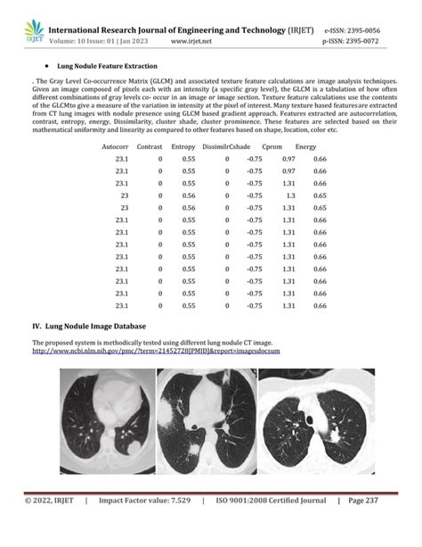 lung nodule feature extraction and classification using improved neural networkalgorithm