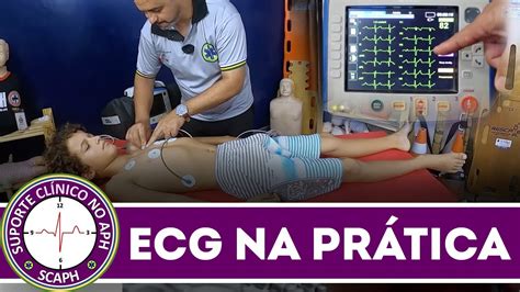 O Que é Ecg Convencional SOLOLEARN