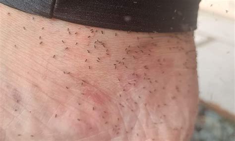 Sa De Confirma Dez Casos De Febre Oropouche Em Santa Catarina