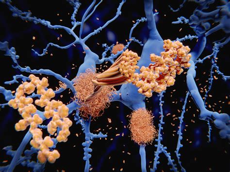 Manipulating Cellular Interactions Of Protein May Enhance Clearing Of