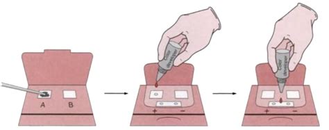 Test de sangre oculta en heces Es útil Digestivo Saludable