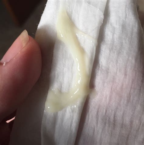 Sorry For The Graphic Image But Is This Discharge Or Part Of My Mucus