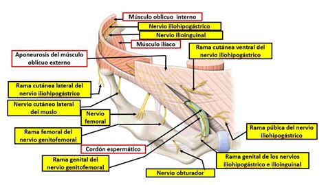 Inervación de la pared anterolateral del abdomen Dolopedia