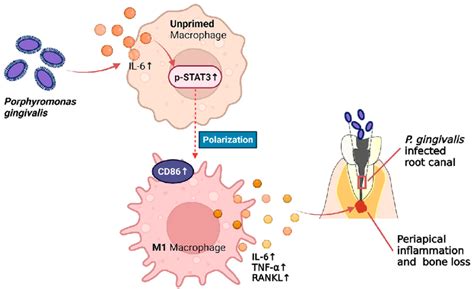 Schematic Illustration P Gingivalis Infection Polarizes Macrophages