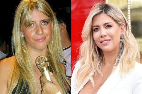 EL ANTES Y DESPUÉS DE LAS CELEBRIDADES ARGENTINAS MÁS CONOCIDAS