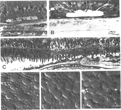 Photoreceptor Morphology And Topography In Eyes With Exudative