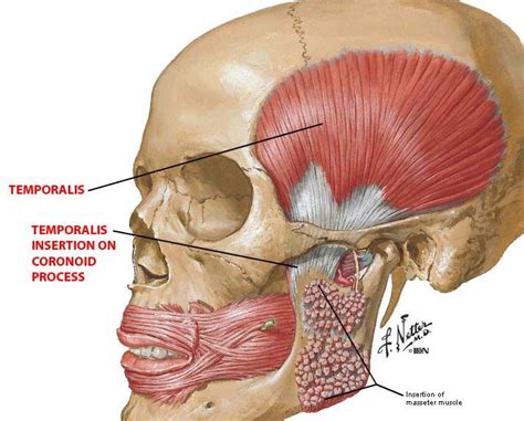 Temporalis Muscle Anatomy Muscles Of The Face Facial Muscles Thyroid