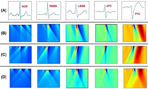 transformation of ecg heartbeat signals using pmat transform a download scientific diagram
