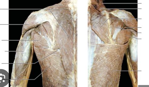 Anatomy Practical Posterior Torso Muscles Cadaver Diagram Quizlet
