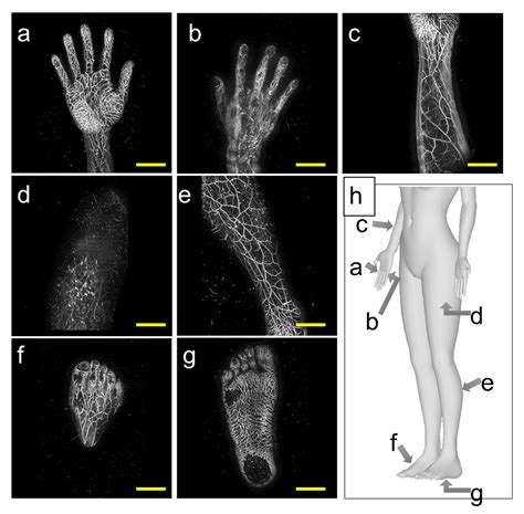 real time 3d photoacoustic visualization system f1000research