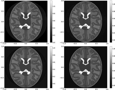 Reconstructions With 20 Gaussian Noise Added Data Top Left F N T