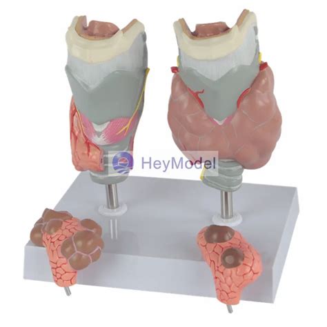 Modelo De Patolog A De La Gl Ndula Humana Modelo De Hipertiroidismo