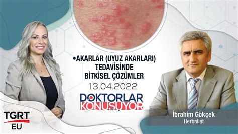Uyuz Hastalığı Nedir Belirtileri ve Tedavi Yöntemleri Nelerdir