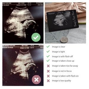 Baby Scan Wallet Keepsake Card Metal Wallet Card Baby Scan Photo