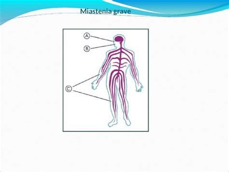 PPT Miastenia Grave La Miastenia Gravis MG Es Una Enfermedad