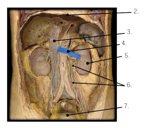 Lab Human Cadaver Urinary Flashcards Quizlet